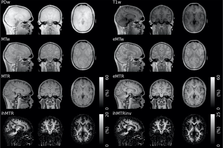 Silent MRI - Centre For Medical Engineering